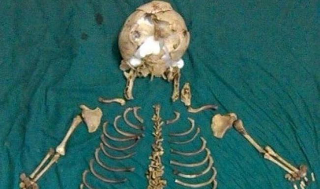 World’s Longest Ectopic Pregnancy: India doctors remove foetus left ...