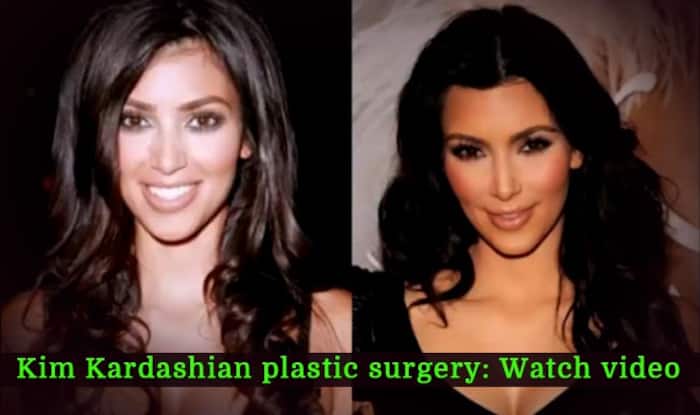 Kim Kardashian before and after plastic surgery (Watch video) | India.com