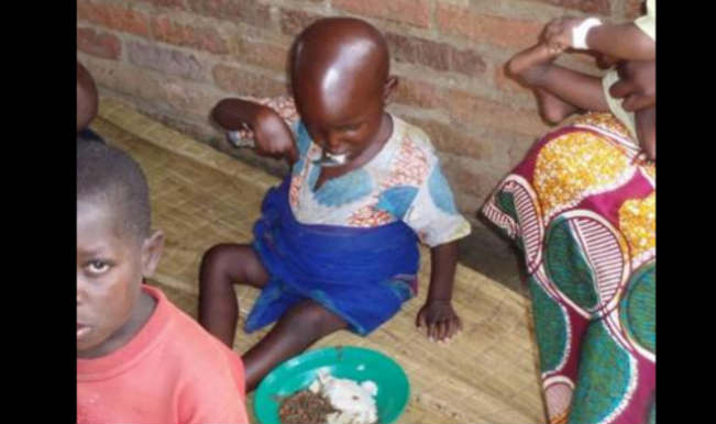 More poor children in school, 30 percent malnourished | India.com