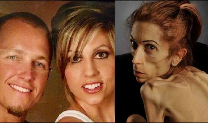 Anorexic California Woman Rachael Farrokh Pleads For Help Watch Video