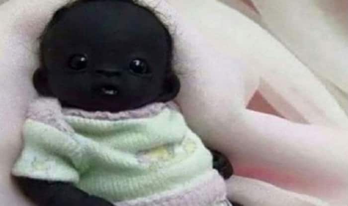 ‘World’s Darkest Baby’ photos create a stir | India.com