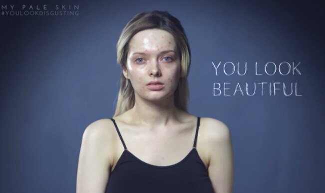 You Look Disgusting – A powerful video by acne-prone blogger ...