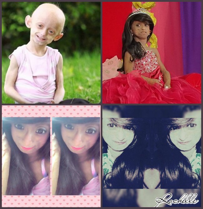 This 18-year-old Progeria patient is living the life of Amitabh ...