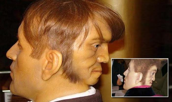 A man born with two faces | OMG! यह इंसान है दो मुंह वाला - Latest News ...