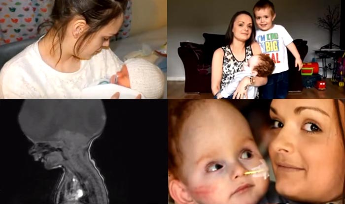 Miracle! When 2-year-old baby without brain said ‘Mummy’ for first time ...