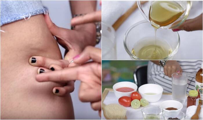 Home remedies to get rid of cellulite fast | India.com