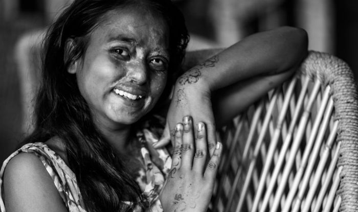 Photographer Will Noor captured Agra acid attack victims and the ...
