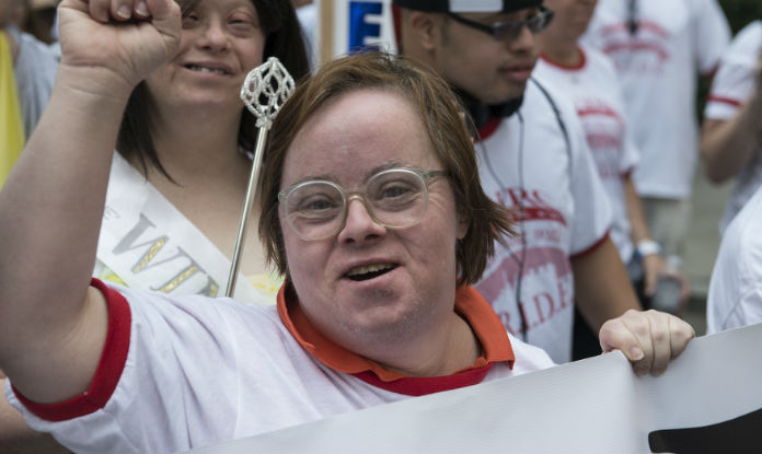 Subtle brain differences prominent in autistic men | India.com