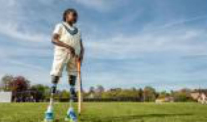 10-year-old amputee can play cricket now thanks to bionic legs | India.com