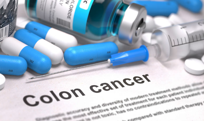 Colorectal Cancer: Symptoms, prevention and treatment for colon cancer ...