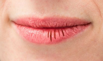 How to use mustard oil in your beauty regimen to get radiant skin and ...