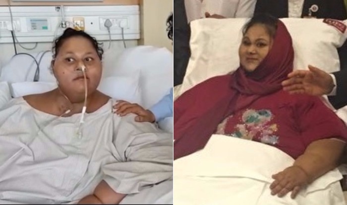 Eman Ahmed Transformation in Abu Dhabi Hospital is Commendable! See ...