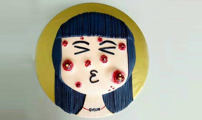 This Pimple Cake Is the New Internet Sensation, Reactions Range From ...