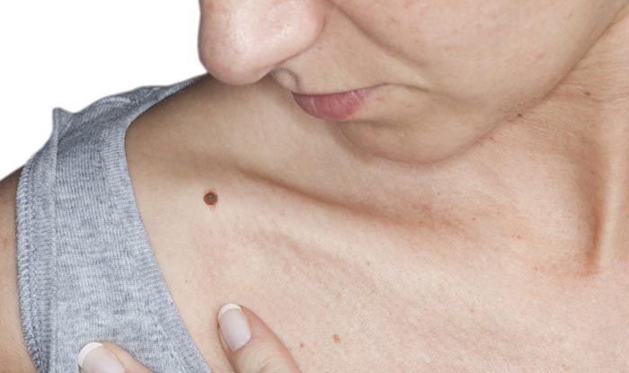 Skin Cancer के खतरे को 40% तक कम करते हैं इस तरह के Body Lotion ...