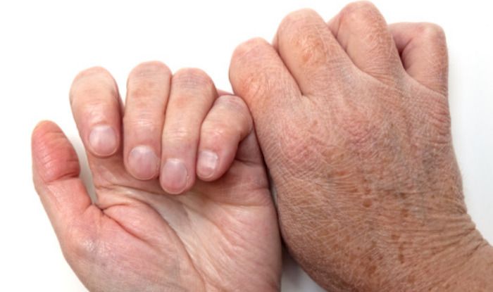 Skin Tends to Become Very Dry During Winter, so Here’s How You Can Keep ...