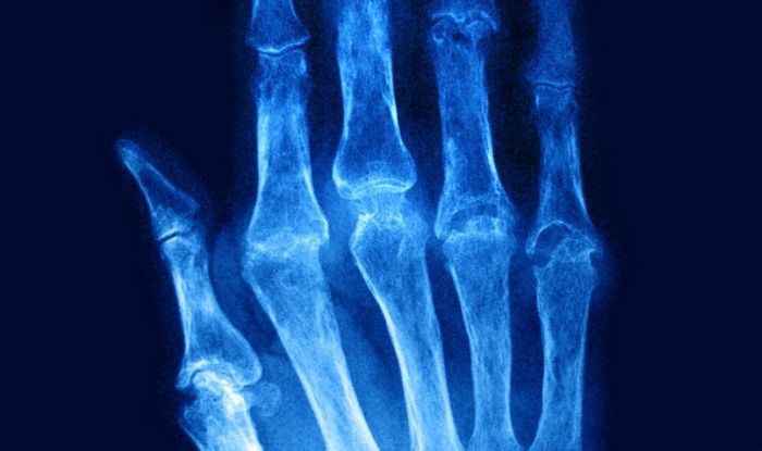 Prolonged Smoking Cessation May Actually Delay or Even Prevent Onset of ...