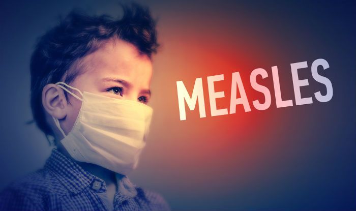 All You Need to Know About Measles