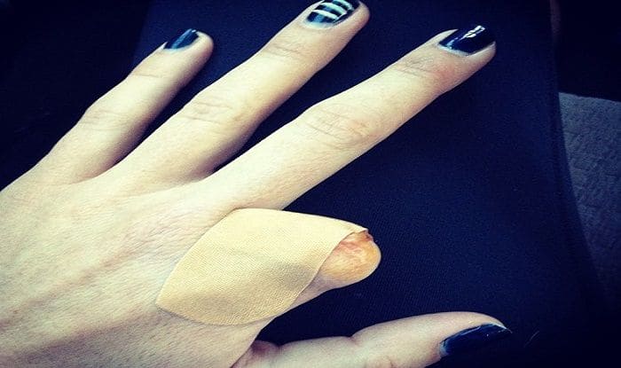 A Manicure Session Leaves a Woman With a Life-Threatening Infection And ...
