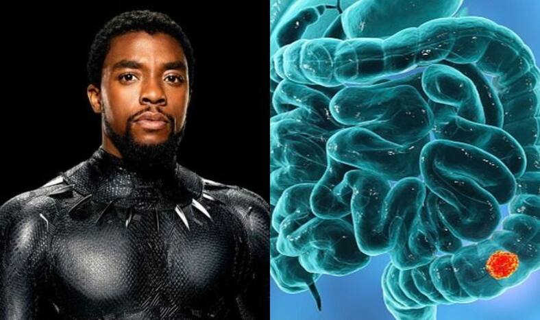 All About Colon Cancer: Symptoms And Treatment of Disease That Took ...