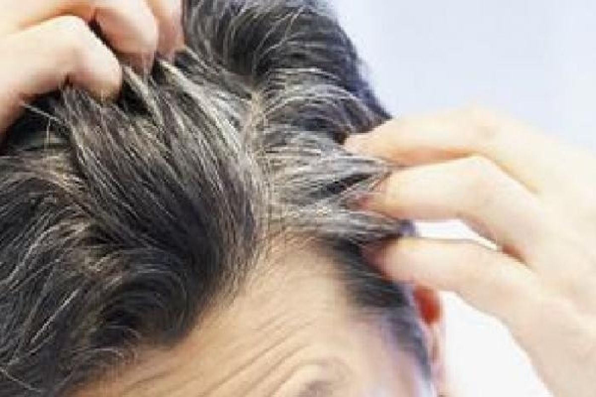 Hair Care Tips: समय से पहले ही सफेद होने लगे हैं बाल? घबराएं नहीं ...