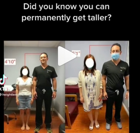 Want to Be Tall? This Doctor Has Gone Viral For Claiming He Can Make ...