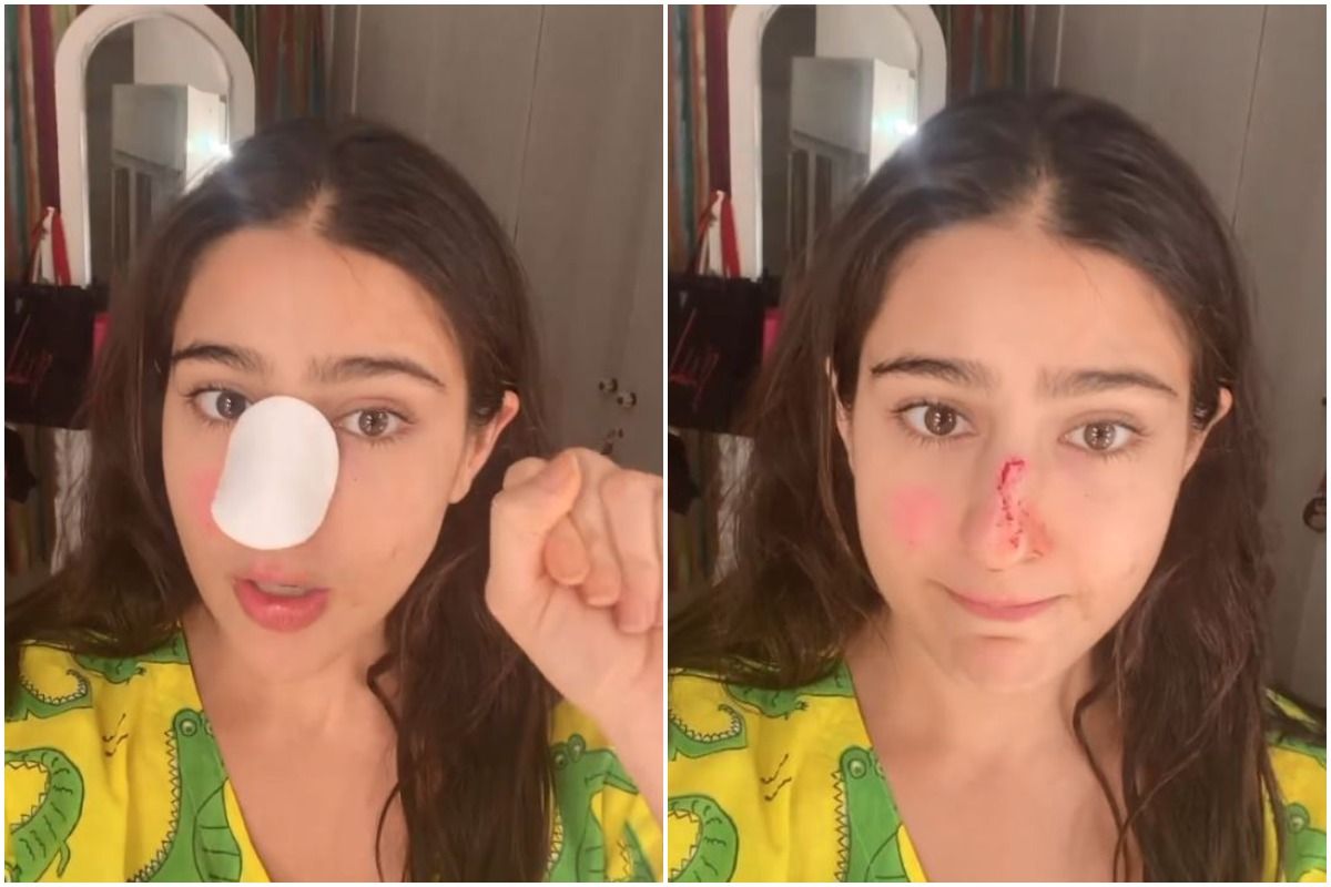 ‘Naak Kaat Di’: Sara Ali Khan Gets Nose Injury, Apologises to Amrita ...