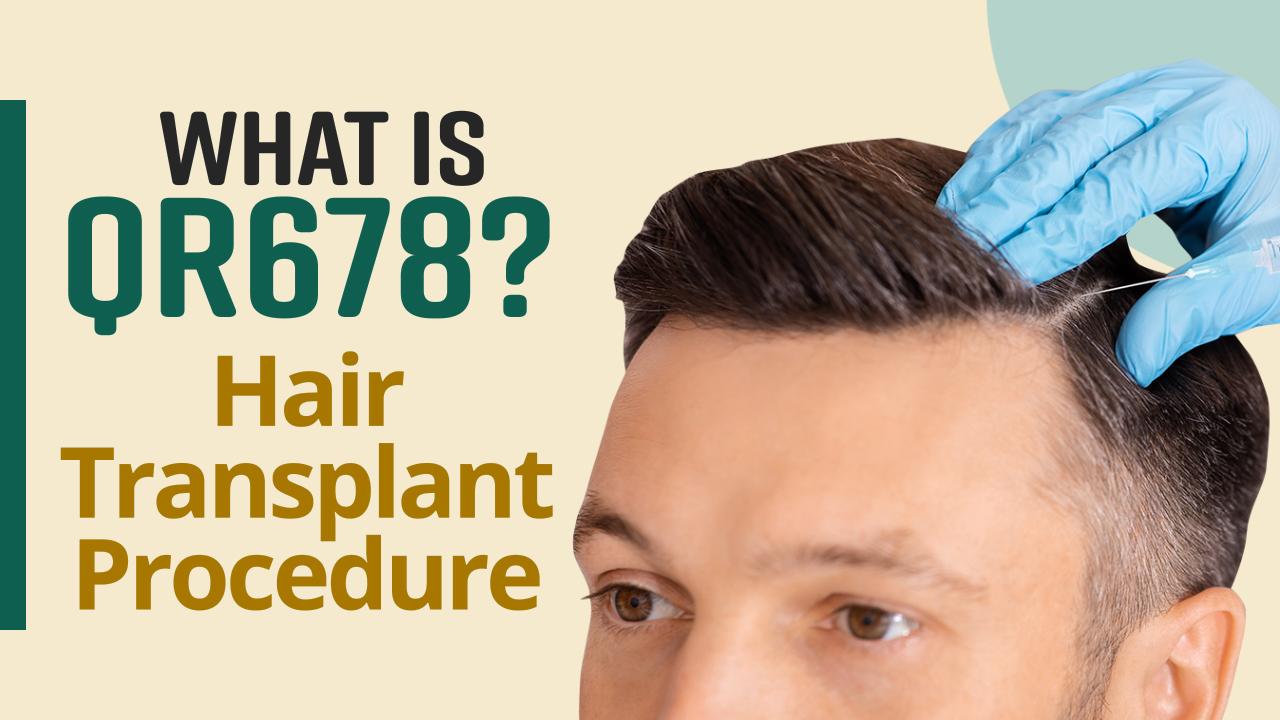 Hair Treatment : What Is QR 678 Hair Transplant ? Here Is All You Need ...