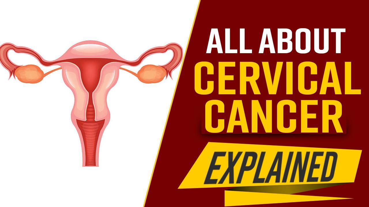 Explained: What Is Cervical Cancer? Early Signs, Causes, Symptoms And ...
