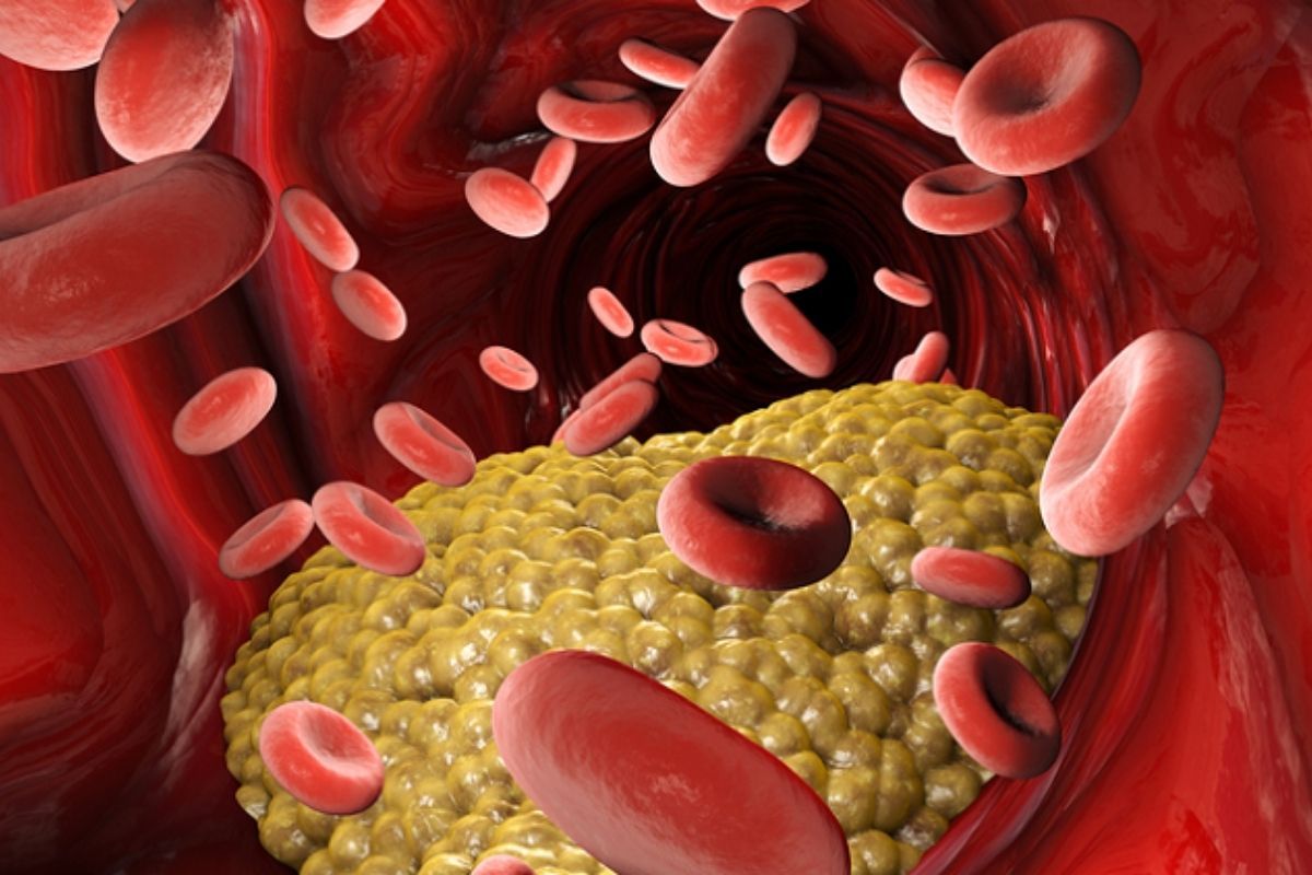 cholesterol Control Tips: तुमचं कोलेस्ट्रॉल वाढलंय?; मग हा रामबाण उपाय करा