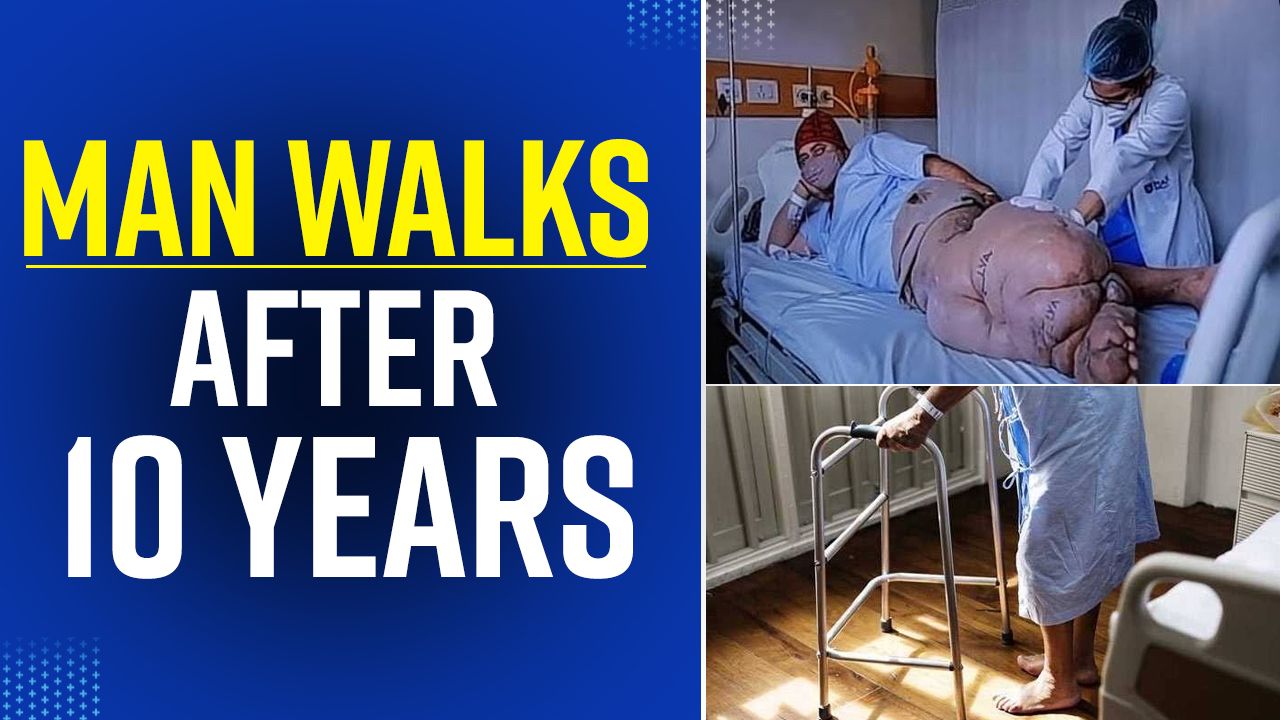 A 40 Year Old Bed Ridden Man With 45Kg Elephantiasis In Left Leg ...