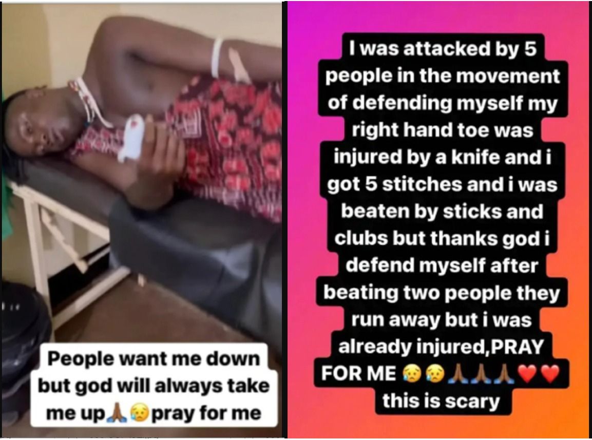 Tanzanian Internet Sensation Kili Paul Attacked With Knife, Beaten With ... Tanzanian Internet Sensation Kili Paul Attacked With Knife, Beaten With ...
