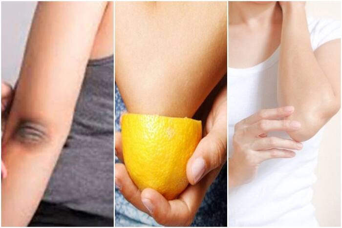 How to Clean Dark Elbows: इन पांच घरेलू नुस्खों से चमका सकते हैं अपनी ...