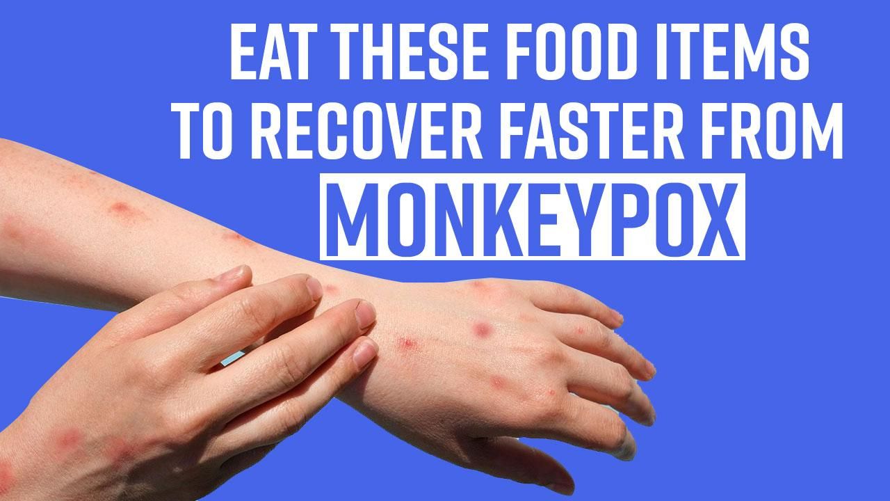 Monkeypox Diet: Top 5 Foods That Will Boost Immunity And Help You ...