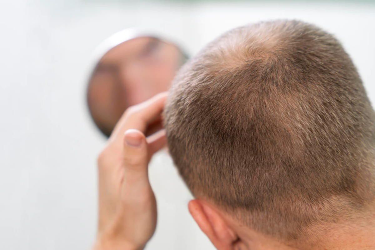 समय से पहले बाल हो रहे हैं सफेद तो अपनाएं ये घरेलू नुस्खे, होंगे चमकदार ...