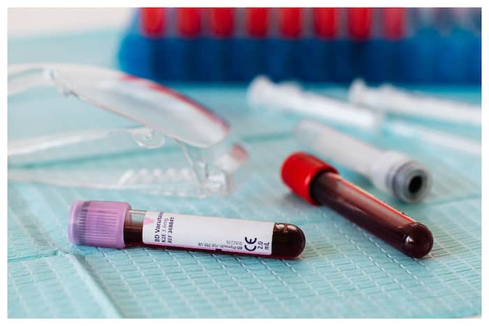New Blood Group Identified That Poses Serious Threats To Babies In ...