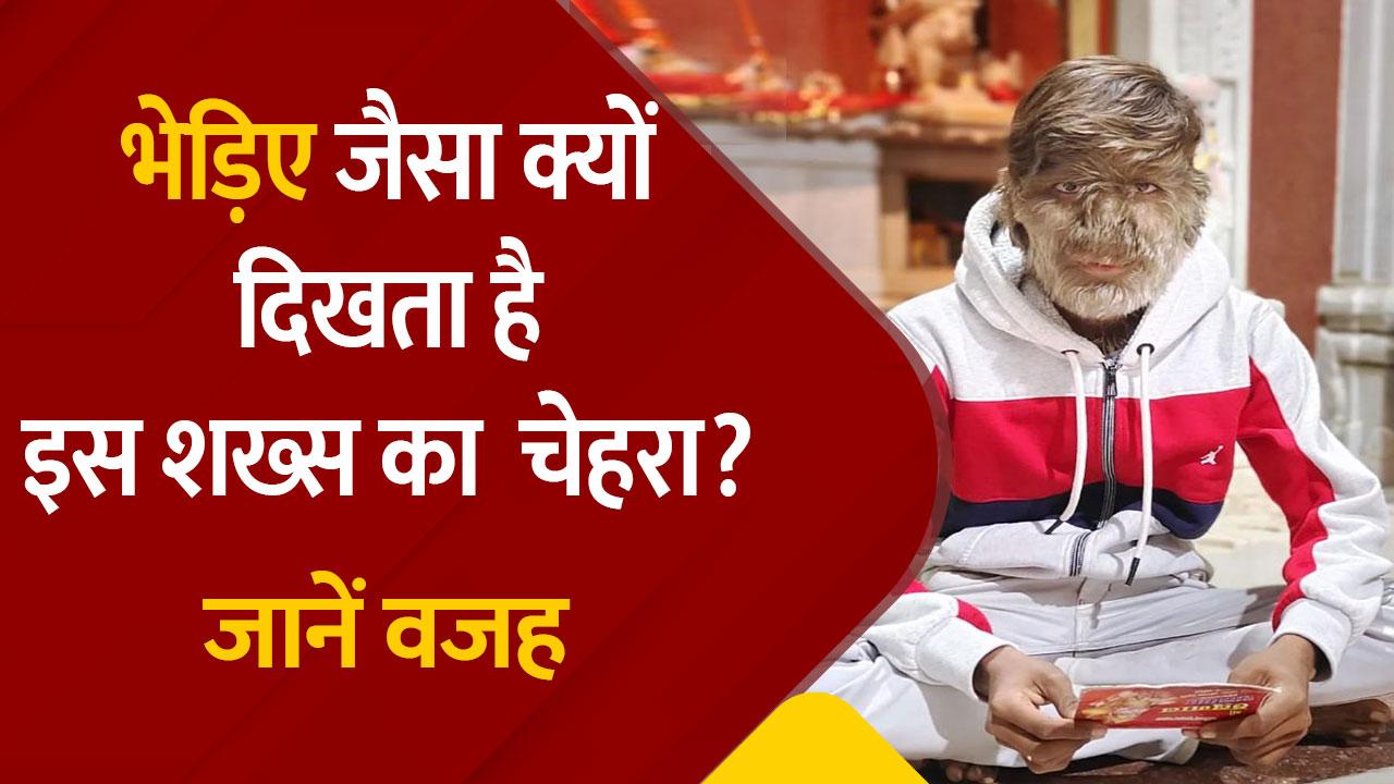 Lalit Patidar: लंबे-लंबे बालों से क्यों ढका है ललित पाटीदार का चेहरा ...