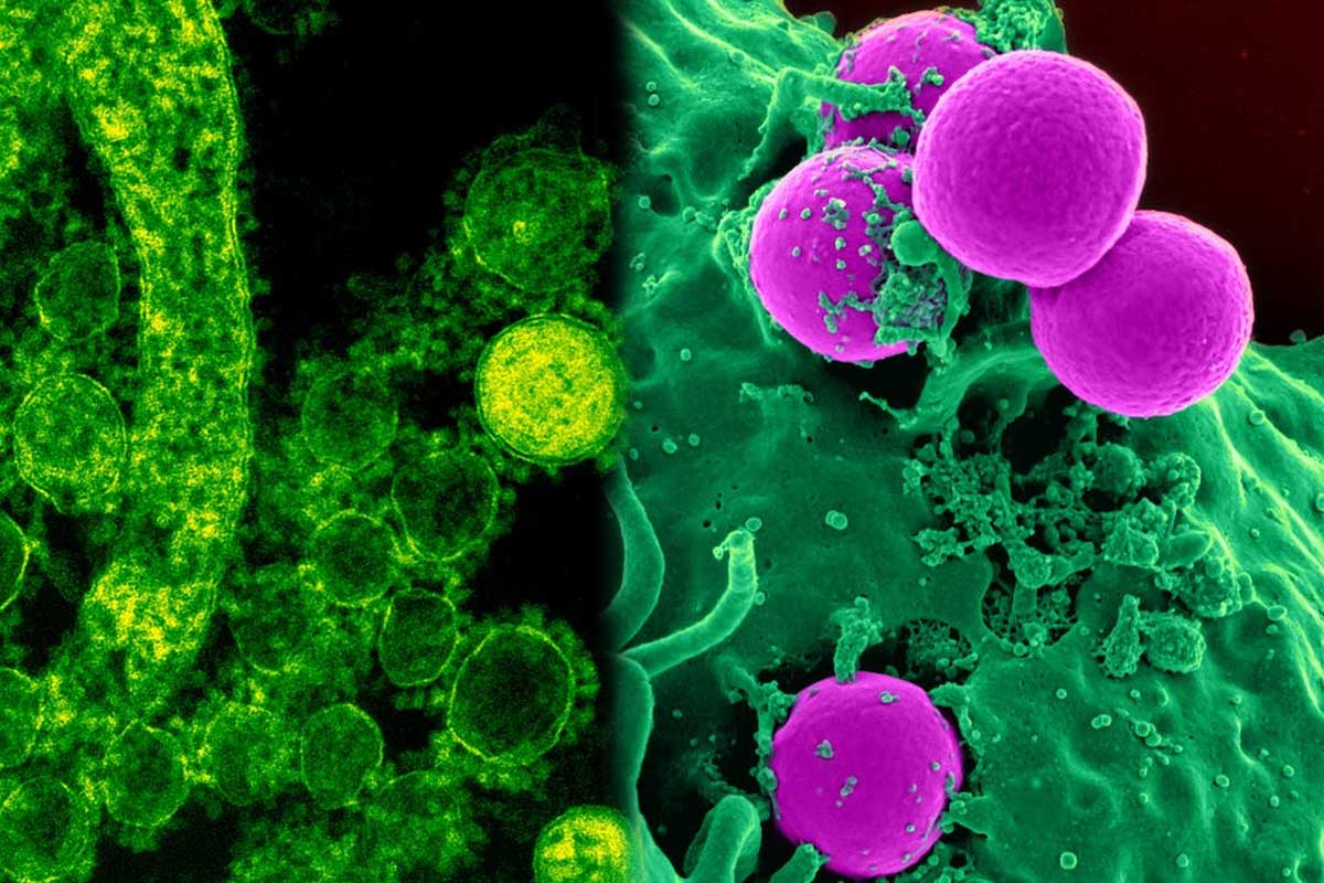 Bacterial infections: दुनियाभर में मौत का दूसरा सबसे बड़ा कारण है ...