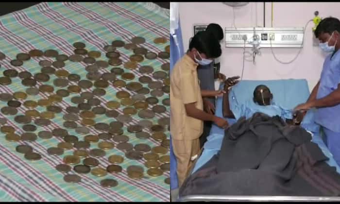 In Karnataka Doctors Remove 187 Coins Stuck Inside Man Stomach