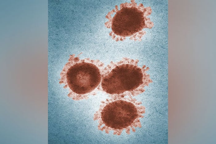Zombie Virus: रूस में वैज्ञानिकों ने 48,500 साल पुराने जॉम्बी वायरस को ...