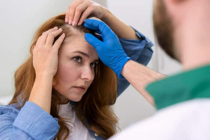 Baldness in Women: Causes, Symptoms And Treatment of Female Pattern ...