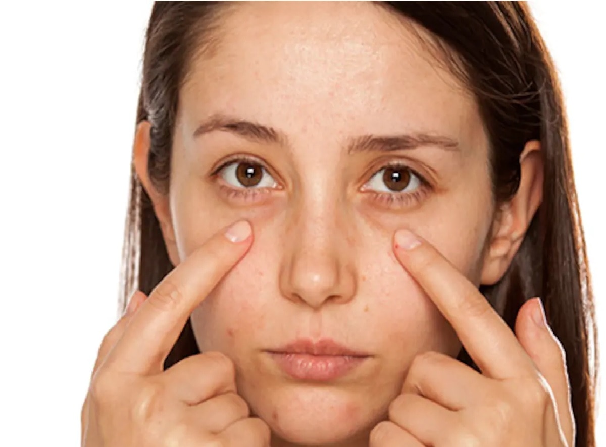 सुबह-सुबह आंखों के नीचे रहता है सूजन, आजमाएं ये 3 झटपट घरेलू नुस्खे