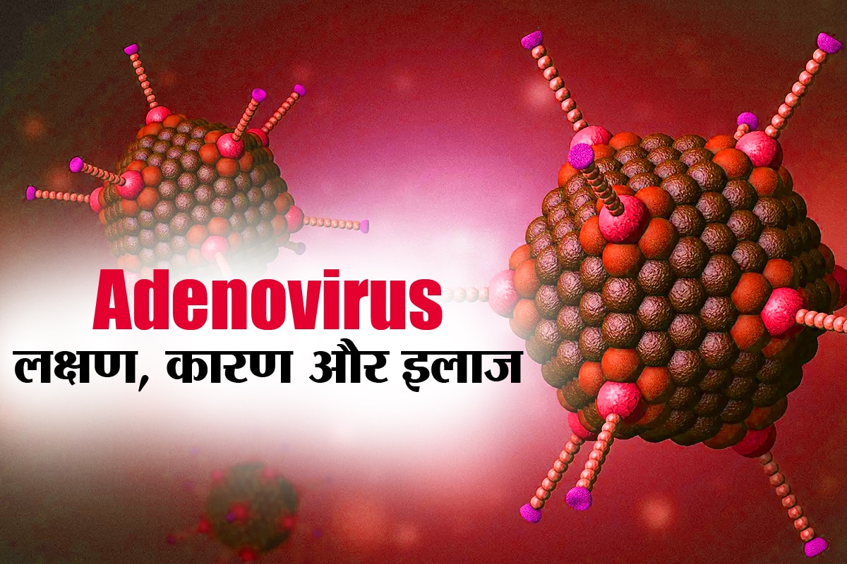 Adenovirus Infections: एडेनोवायरस क्या है, इसके लक्षण, कारण और इलाज ...