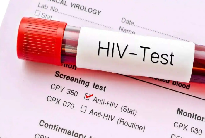 44 Prisoners Tested HIV-Positive In Uttarakhand Haldwani Jail