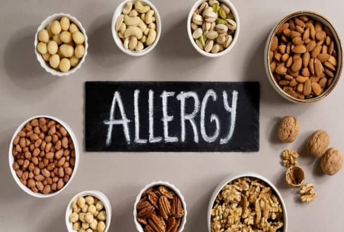 Food Allergy vs Food Intolerance: What is The Difference And How Can ...