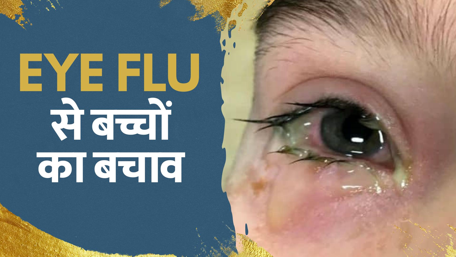 Eye Flu Treatment: सावधान! बच्चों में तेजी से फैल रहा Eye Flu, जानें ...
