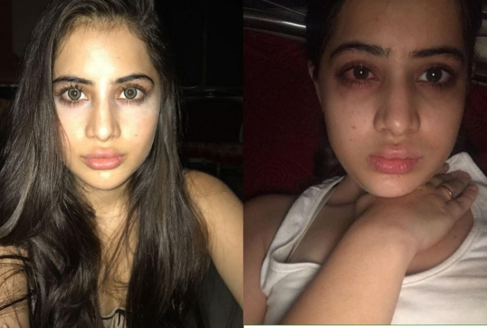 Urfi Javed Opens Up About Lip Fillers And Botox: Didnt Have That Much Money