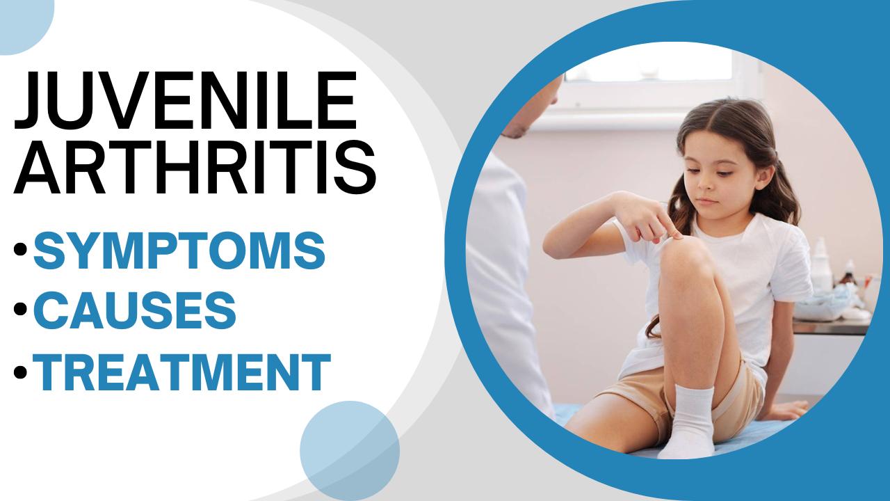 Juvenile Arthritis: What Is It? Symptoms, Causes And Treatment ...