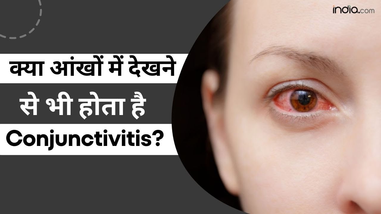 Eye Flu: Conjunctivitis क्या संक्रमित व्यक्ति की आंखों में देखने से होता है? जानें लक्षण