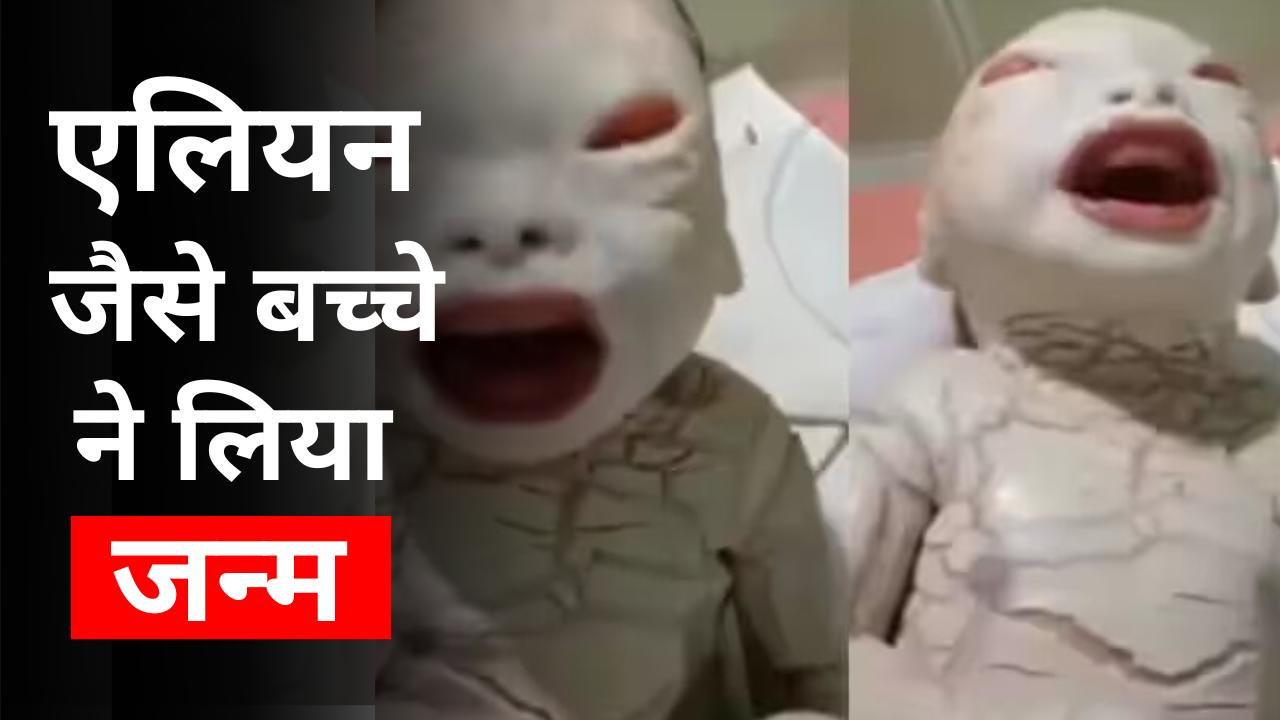 Alien Child Birth: महिला ने एलियन जैसे बच्चे को दिया जन्म, डॉक्टर्स को ...