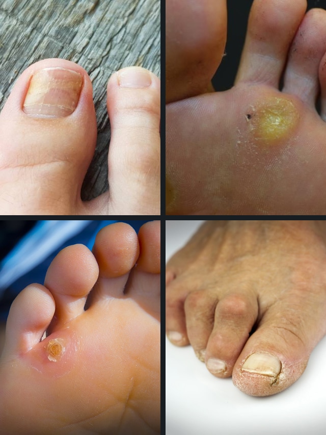 10 Common Foot Problems and How to Manage Them